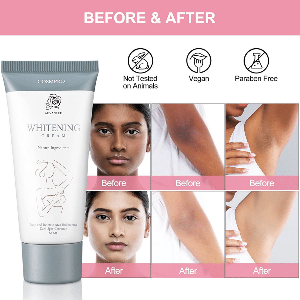Best Skin Whitening Cream Best Skin Whitening Cream